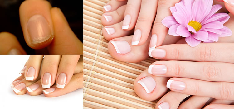 Unhas fracas e quebradiças, saiba o que fazer